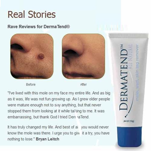 Dermatend Cream Price in Lahore,Karachi,Pakistan